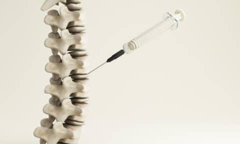 Infiltration therapy - Traumatologie und Orthopädie Mallorca