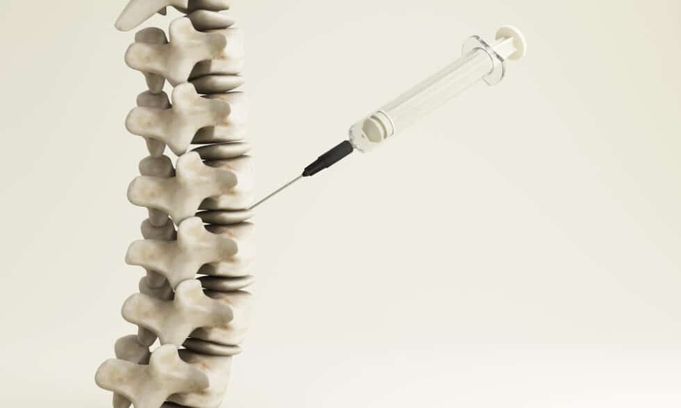 Infiltration therapy - Traumatologie und Orthopädie Mallorca